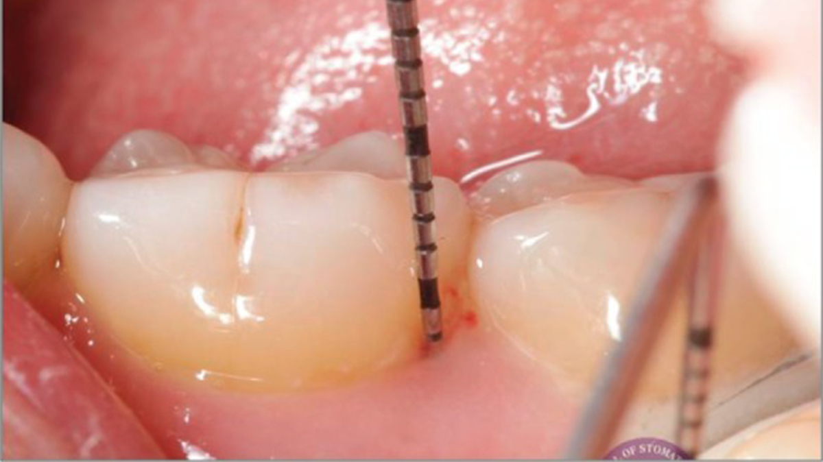 News - What is Orthodontic Treatment?